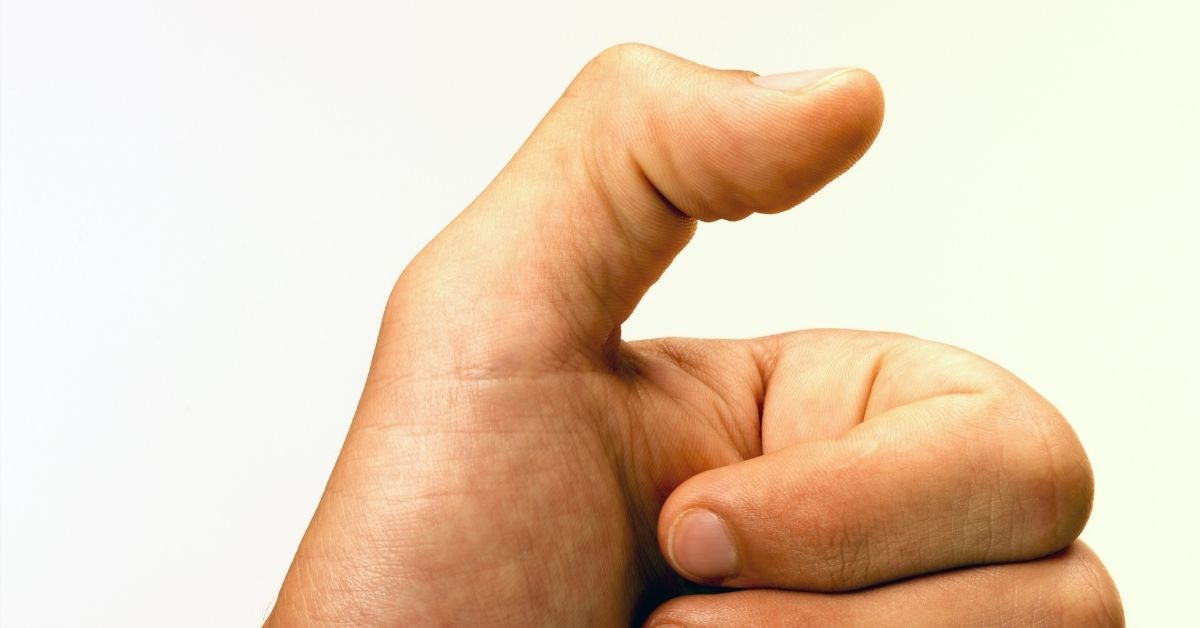 What about trigger thumb release surgery? - Dr. Samuel Galle